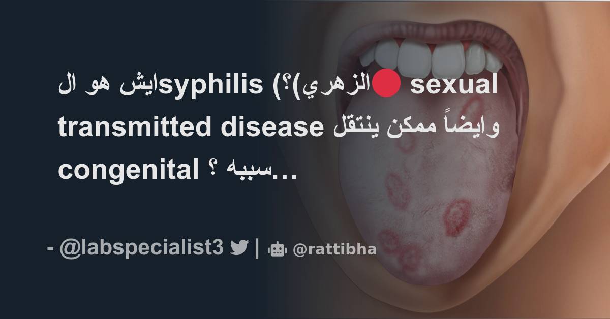 ايش هو الsyphilis (الزهري)؟🔴 sexual transmitted disease وايضاً ممكن ...