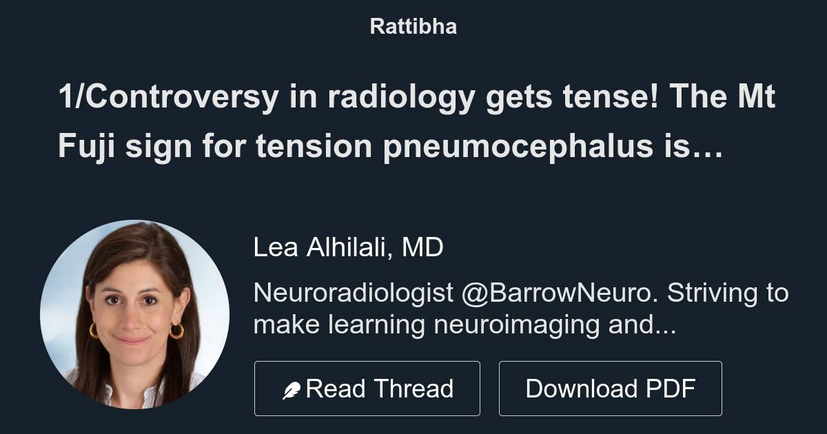 1/Controversy in radiology gets tense! The Mt Fuji sign for tension ...