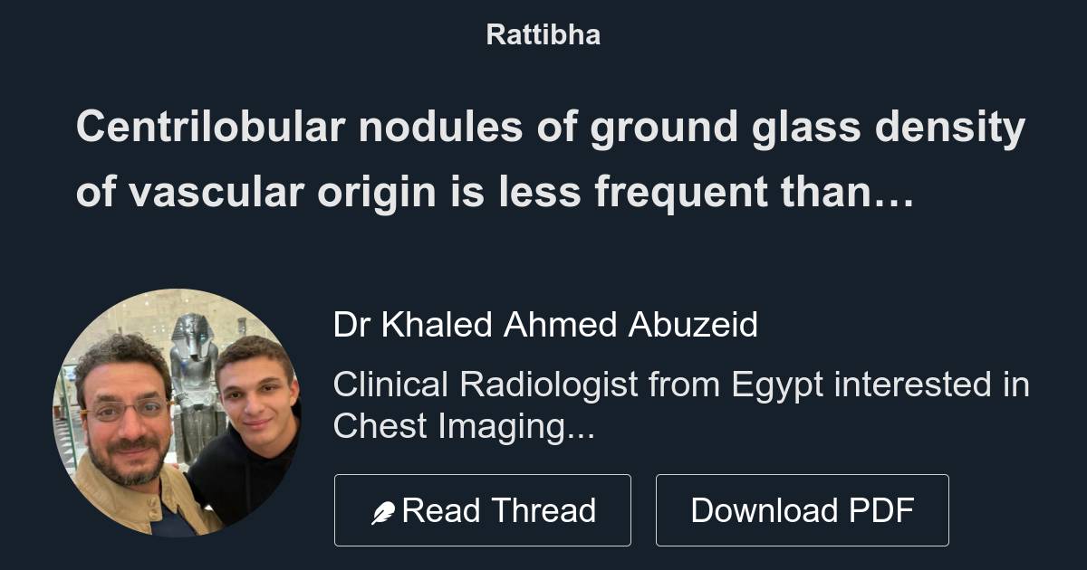 Centrilobular nodules of ground glass density of vascular origin is ...