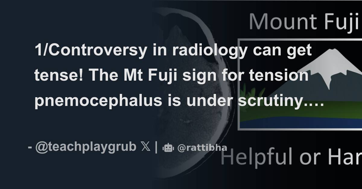 1/Controversy in radiology can get tense! The Mt Fuji sign for tension ...