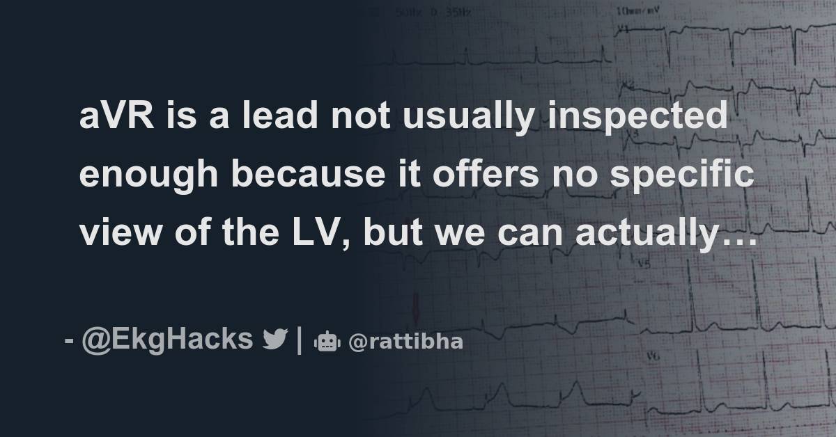aVR is a lead not usually inspected enough because it offers no ...