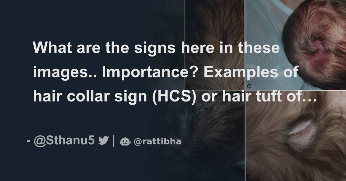 What are the signs here in these images.. Importance? - Thread from ...