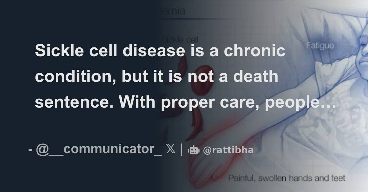 Sickle cell disease is a chronic condition, but it is not a death ...