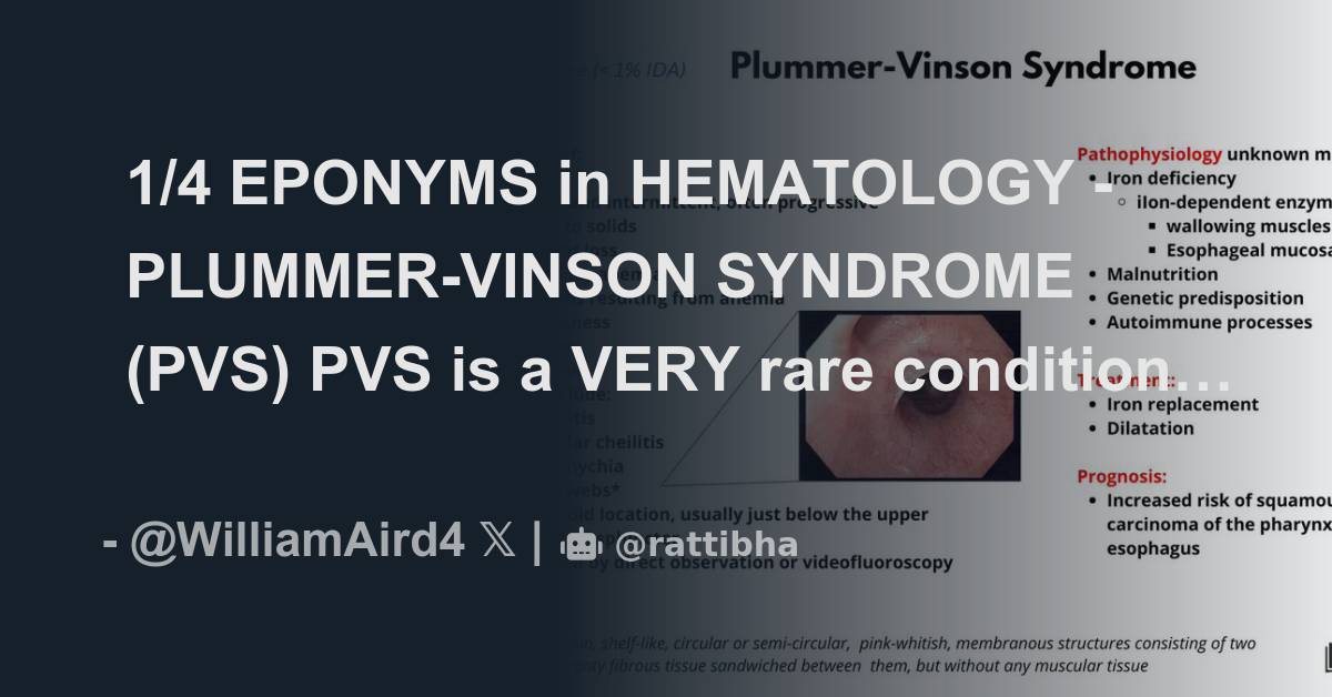 1/4 EPONYMS in HEMATOLOGY - PLUMMER-VINSON SYNDROME (PVS) PVS is a VERY ...