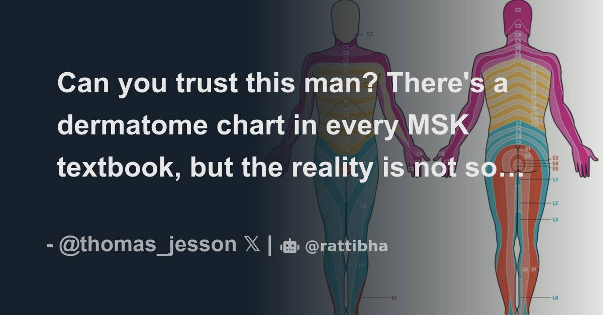 Can you trust this man? There's a dermatome chart in every MSK textbook ...