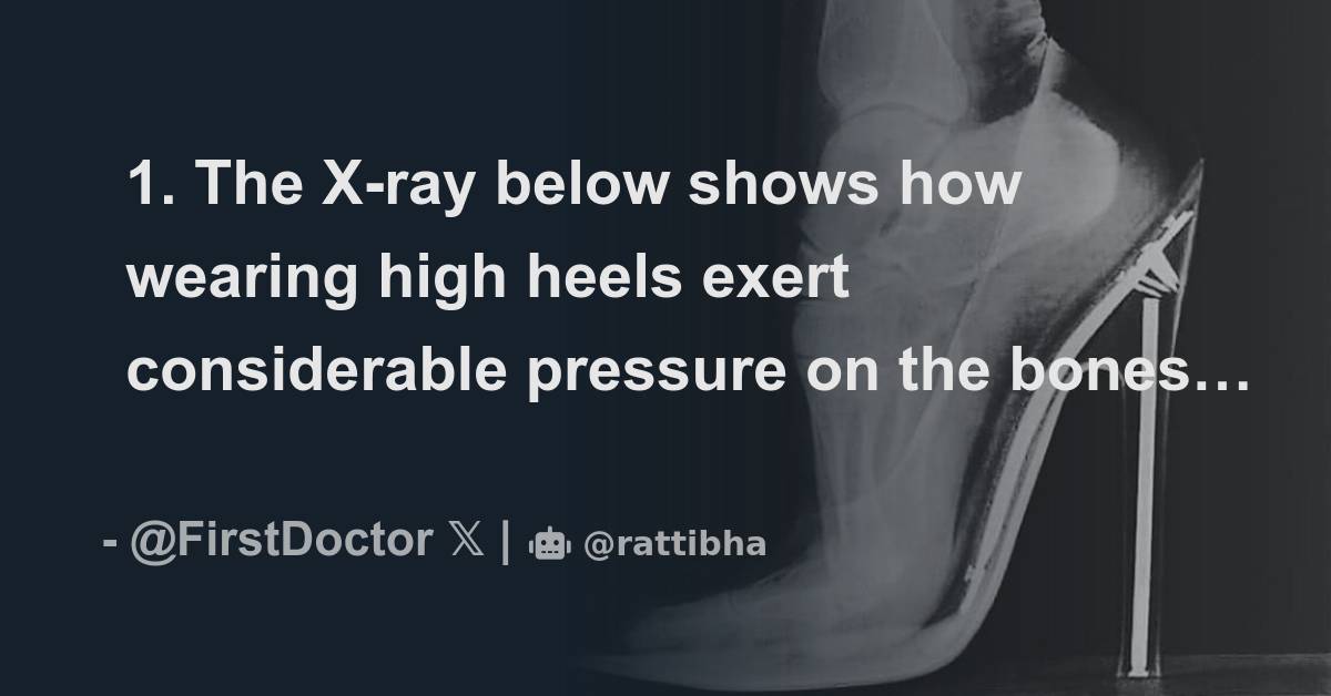 1. The X-ray below shows how wearing high heels exert considerable ...