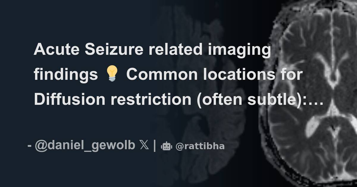 Acute Seizure related imaging findings 💡 Common locations for Diffusion ...