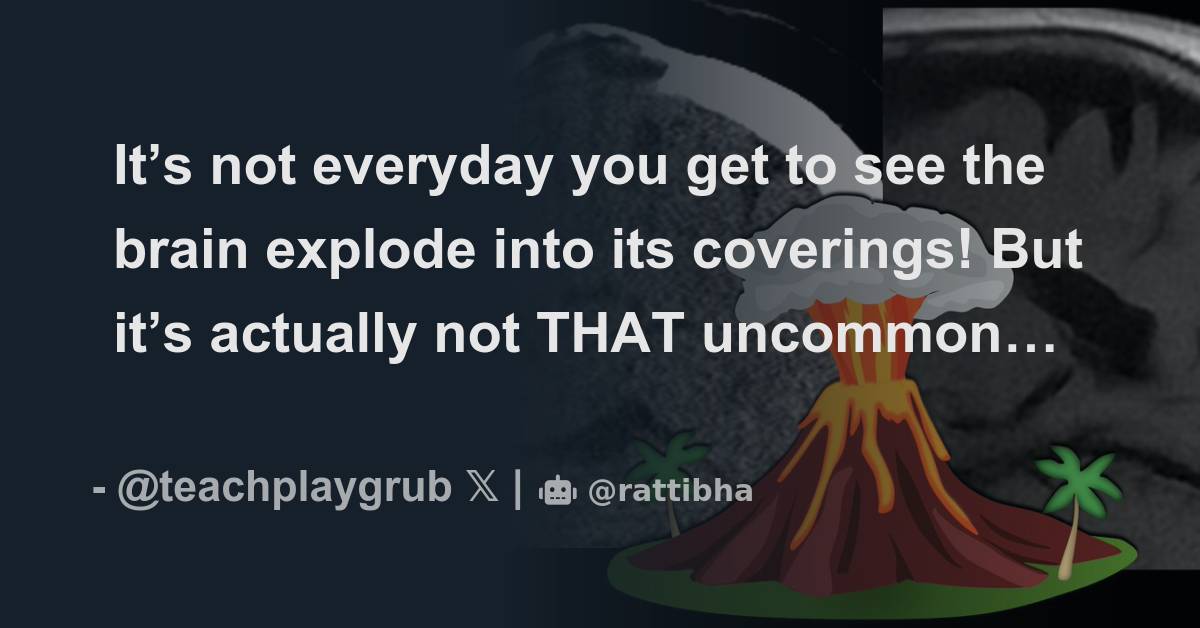 It’s not everyday you get to see the brain explode into its coverings ...