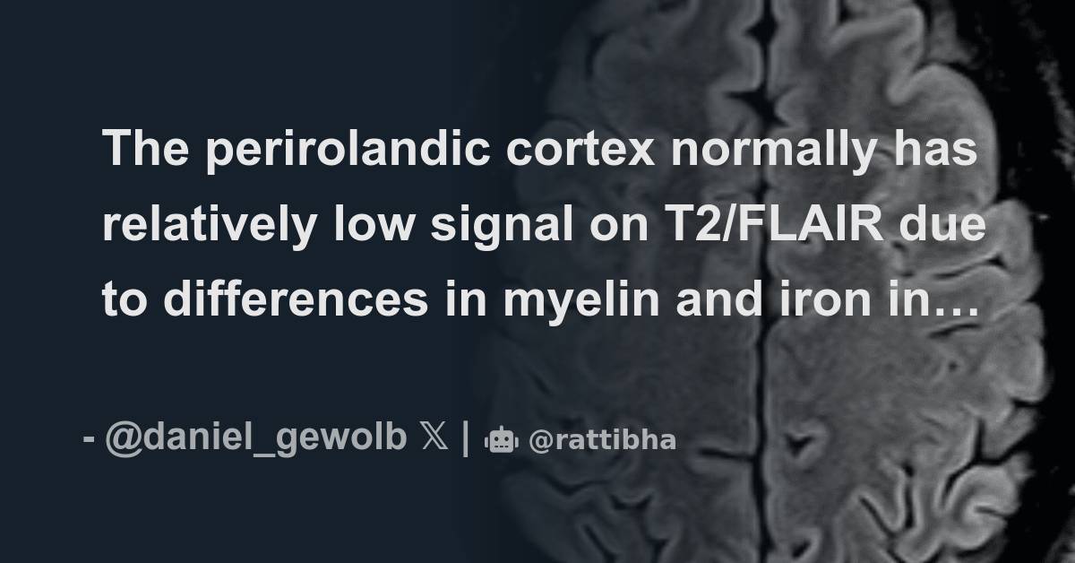 The perirolandic cortex normally has relatively low signal on T2/FLAIR ...