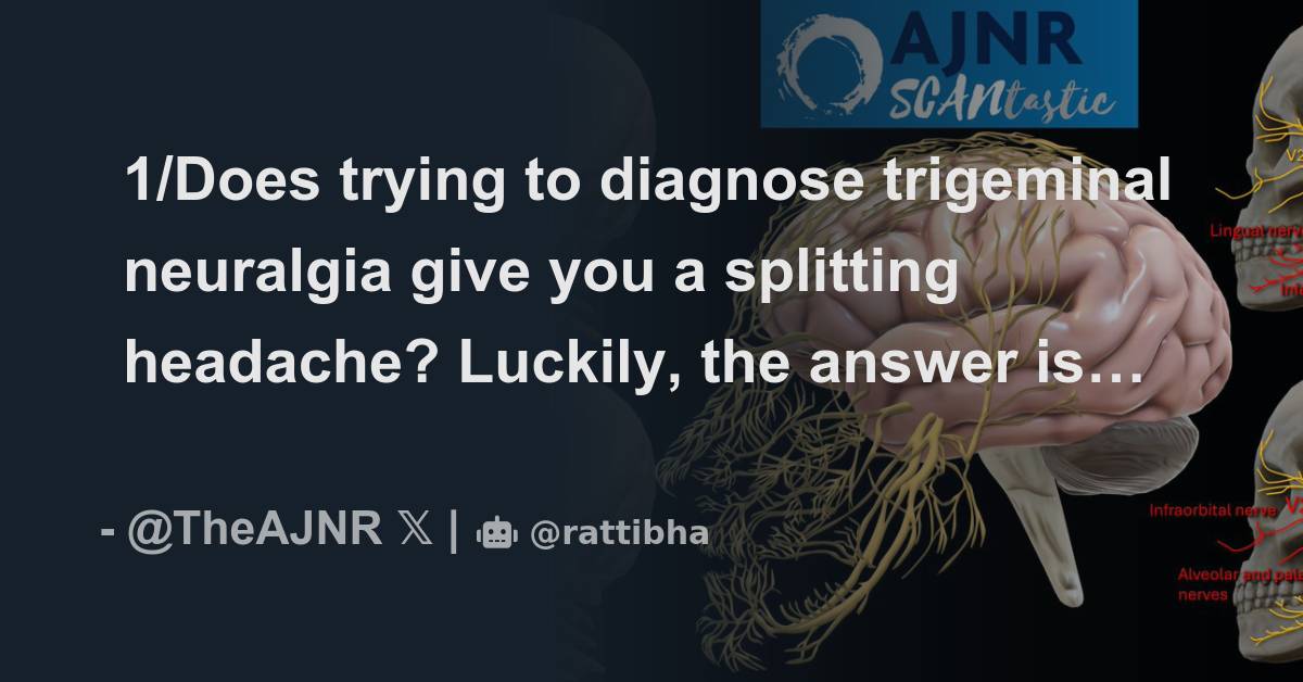 1/Does trying to diagnose trigeminal neuralgia give you a splitting headache? Luckily, the ...