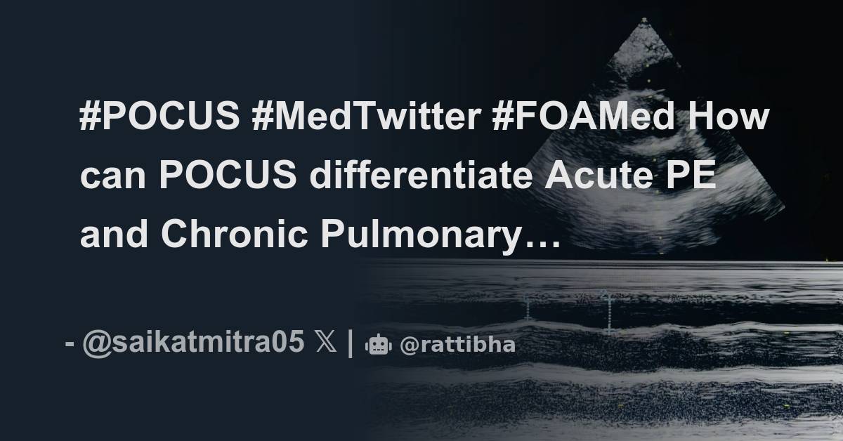 #POCUS #MedTwitter #FOAMed How can POCUS differentiate Acute PE and ...
