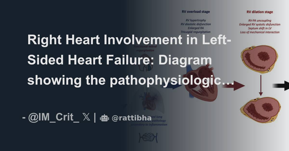 Right Heart Involvement in Left-Sided Heart Failure: Diagram showing ...