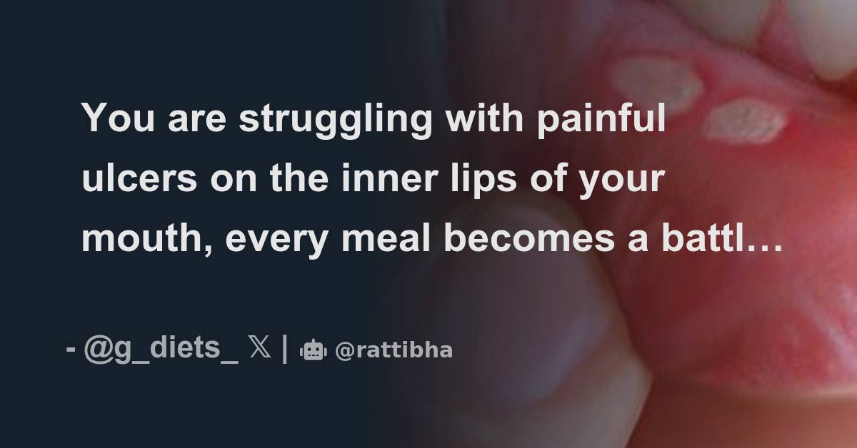 You Are Struggling With Painful Ulcers On The Inner Lips Of Your Mouth you-are-struggling-with-painful-ulcers-on-the-inner-lips-of-your-mouth