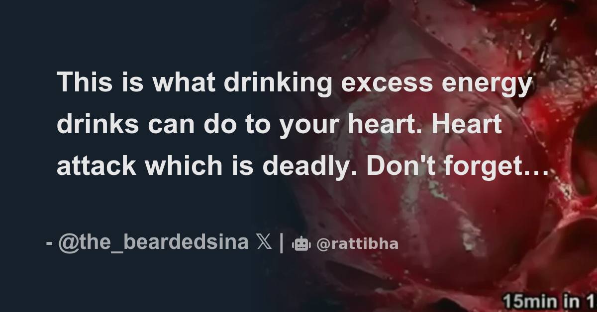 This is what drinking excess energy drinks can do to your heart. Heart attack which is deadly ...