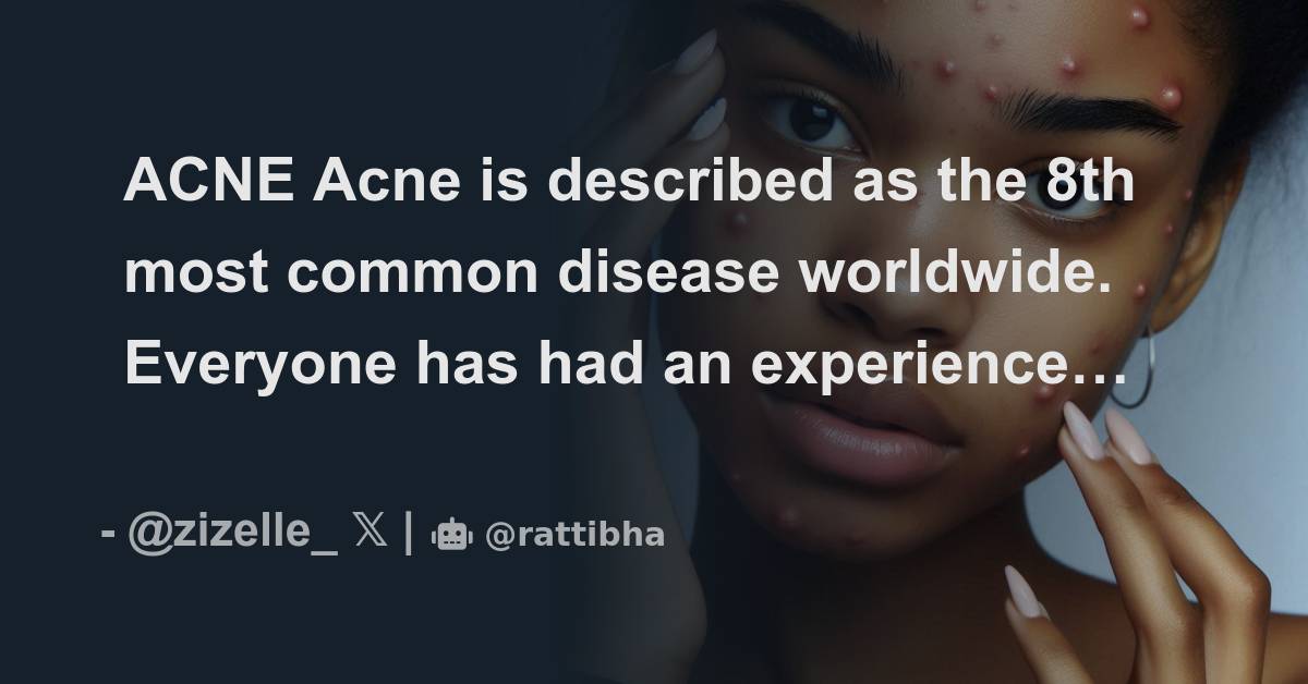 ACNE Acne is described as the 8th most common disease worldwide ...