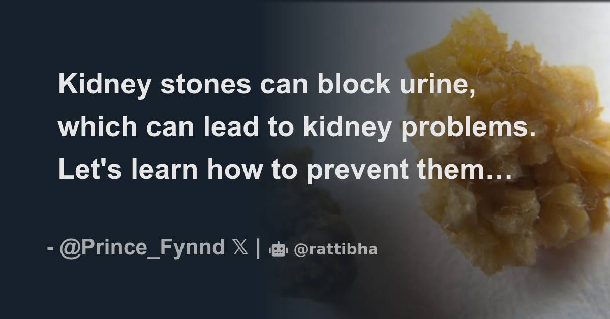 Kidney stones can block urine, which can lead to kidney problems. Let's ...