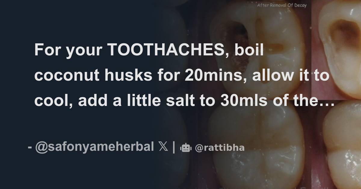 For your TOOTHACHES, boil coconut husks for 20mins, allow it to cool ...