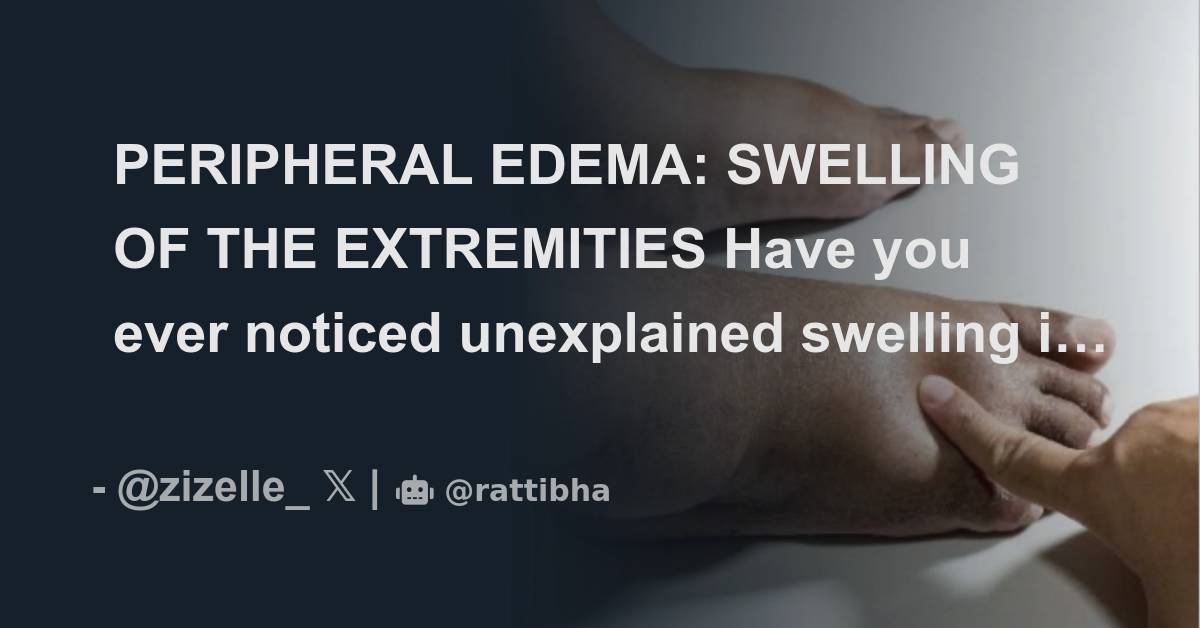 PERIPHERAL EDEMA: SWELLING OF THE EXTREMITIES Have you ever noticed ...